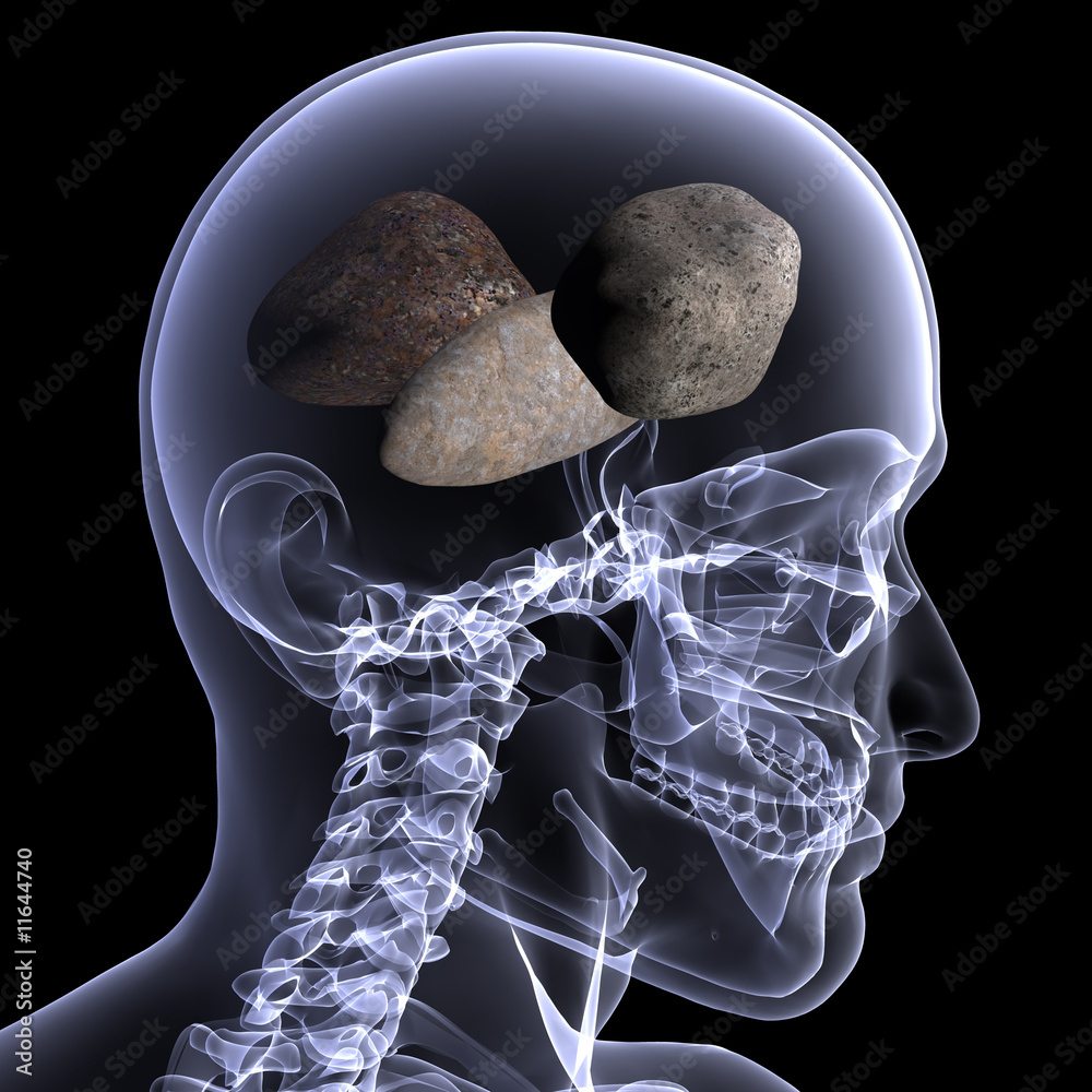Skeleton X-Ray - Rocks In His Head Stock Illustration | Adobe Stock