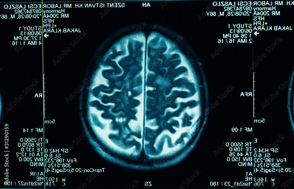sharp ct scan of the human brain Stock Photo | Adobe Stock