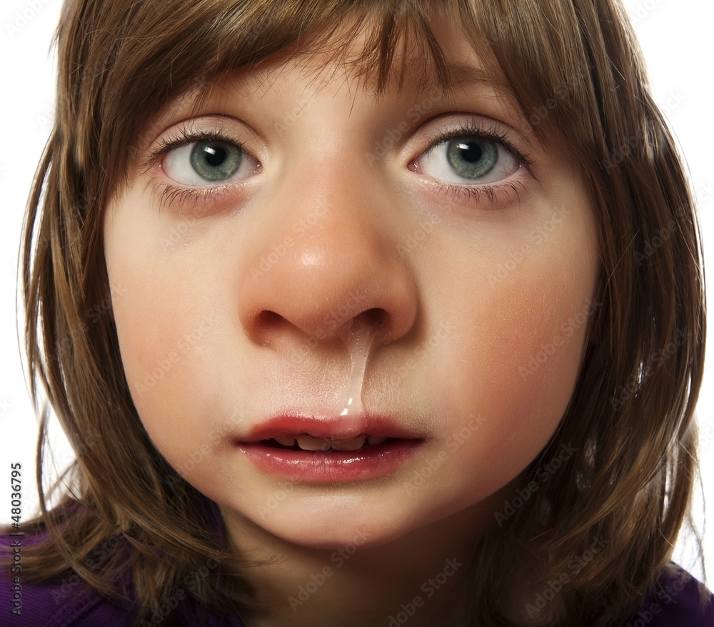 runny nose - cold - ill little girl - funny concept Stock Photo | Adobe ...