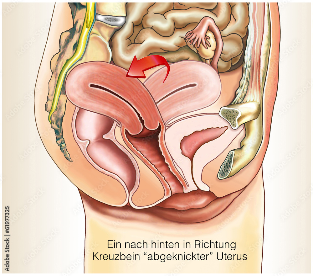 Weibliche Geschlechtsorgane.Uterusverschiebung Stock Illustration | Adobe Stock