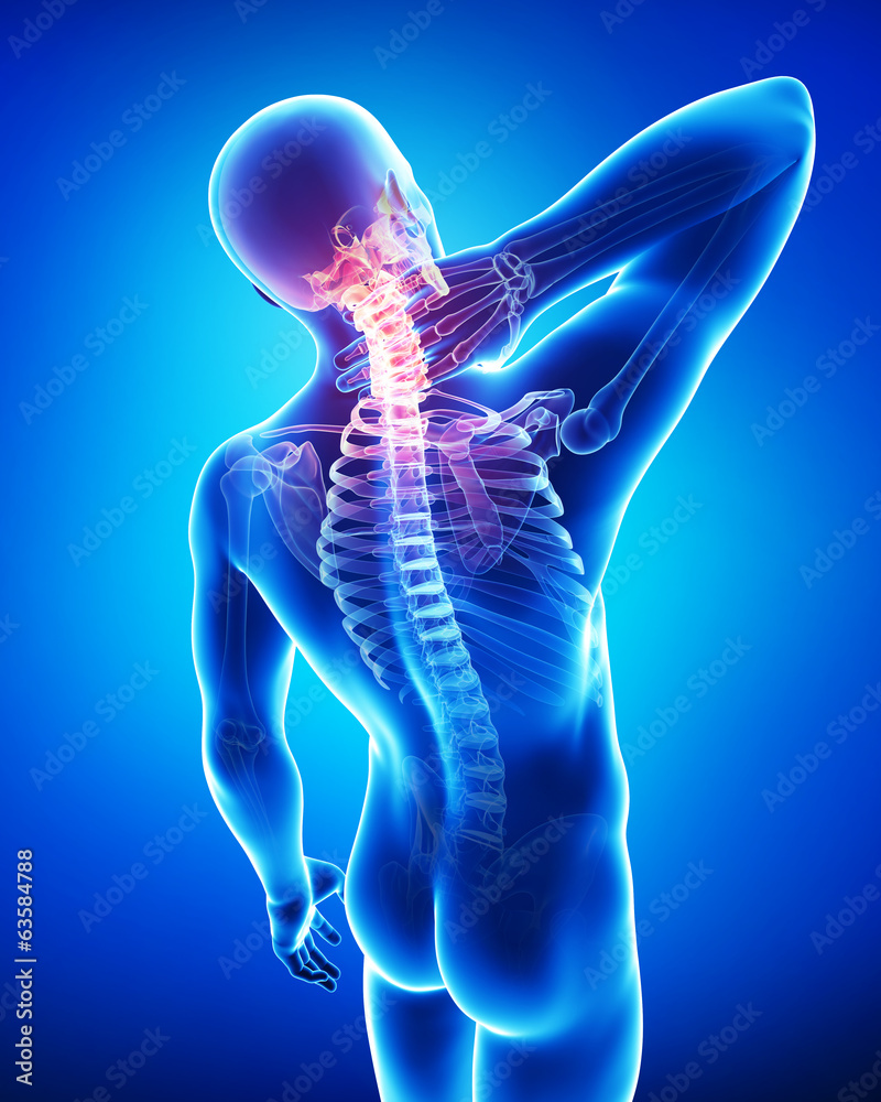Anatomy of male neck pain in blue Stock Illustration | Adobe Stock