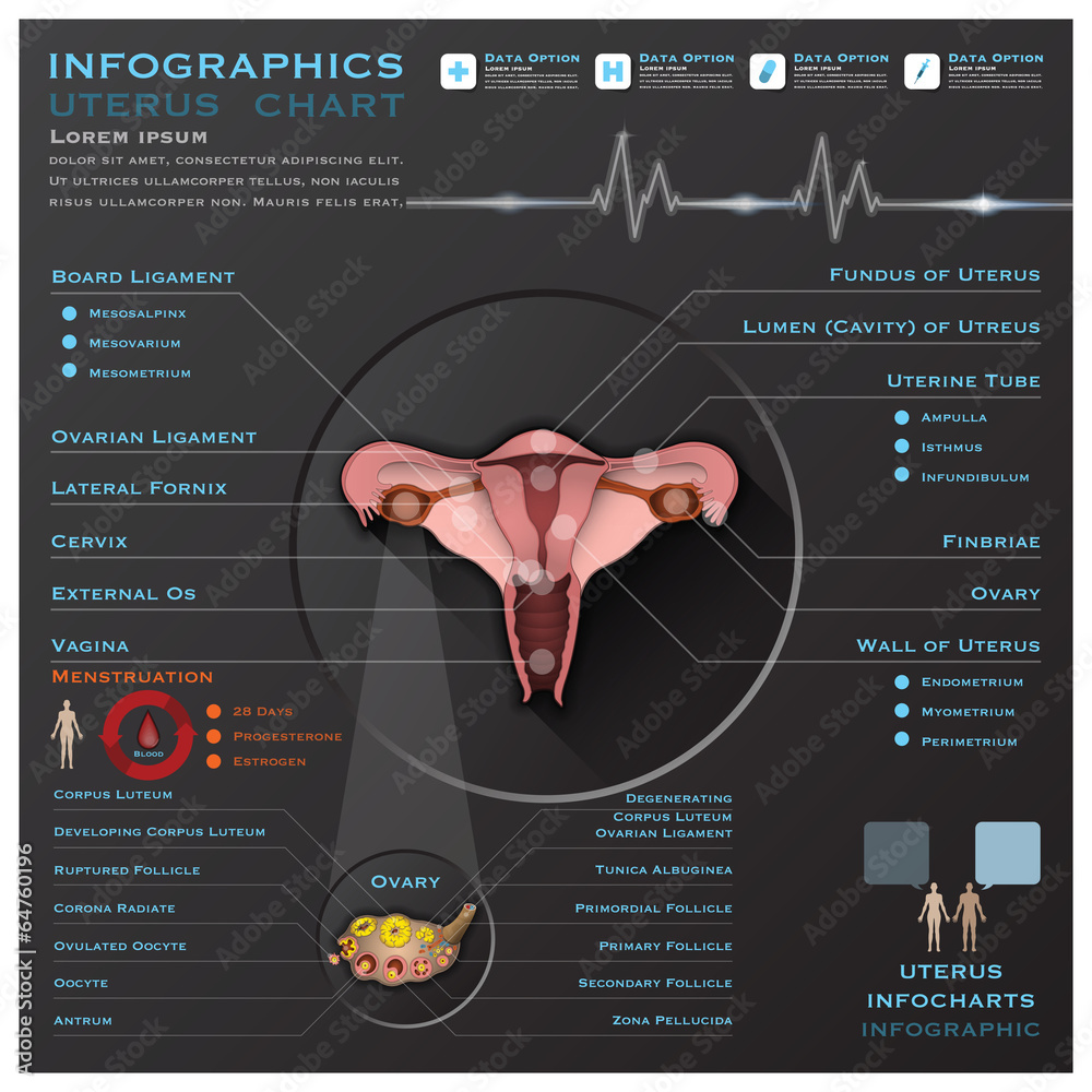 Uterus And Ovary Anatomy System Medical Infographic Infochart Stock ...