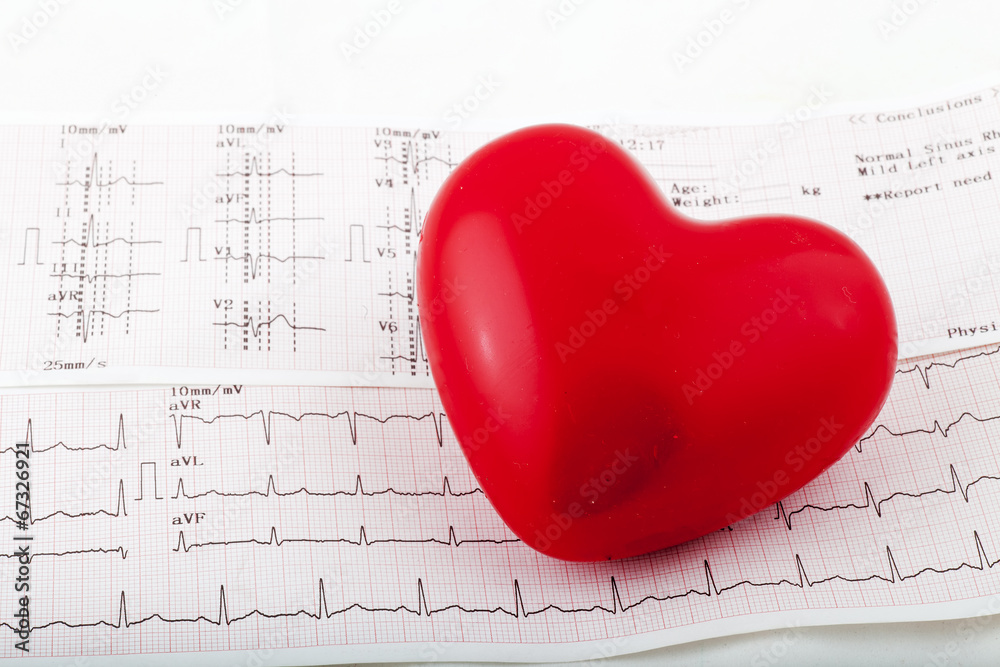 Stethoscope on an electrocardiogram (ECG) chart Stock Photo | Adobe Stock