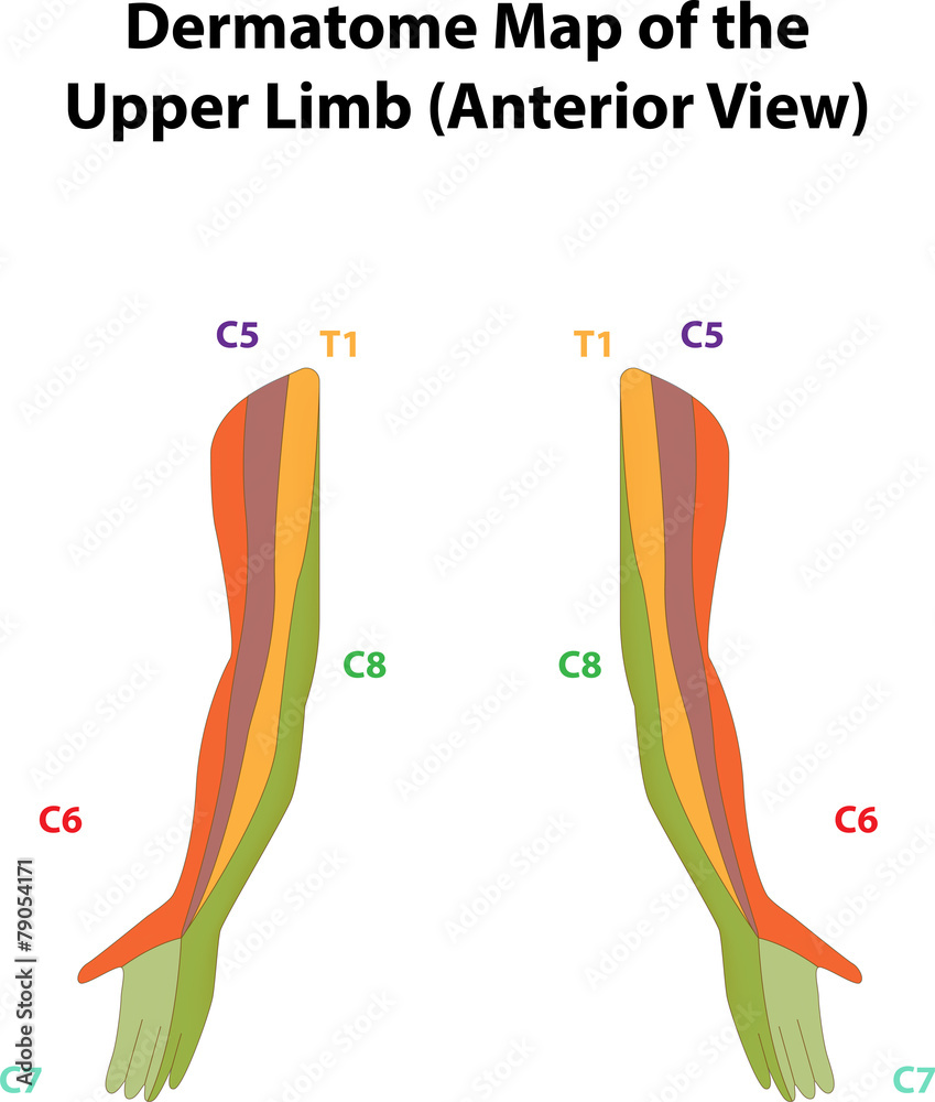 Dermatome Map of the Upper Limb Stock Vector | Adobe Stock