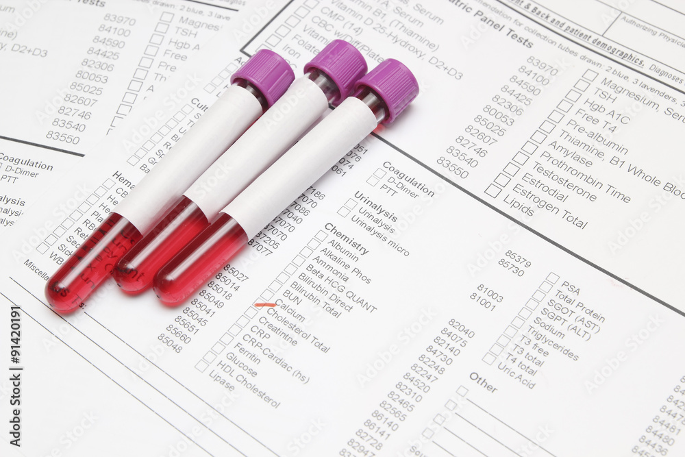 Form to fill in the results of biochemistry blood tests Stock Photo ...