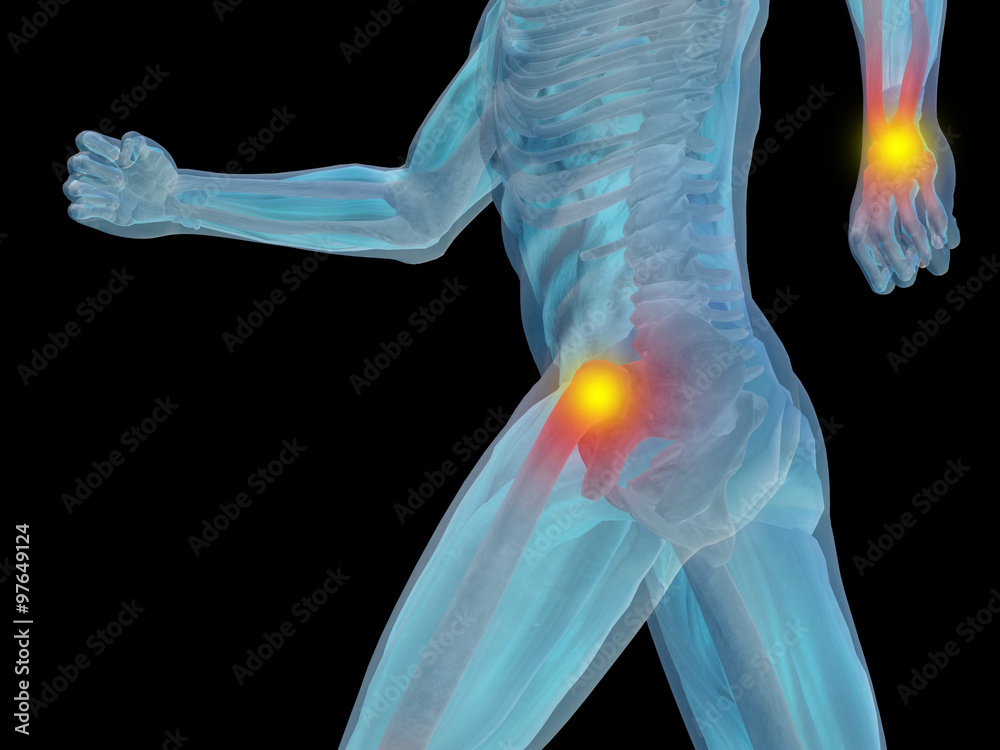 Conceptual human pain anatomy Stock Illustration | Adobe Stock