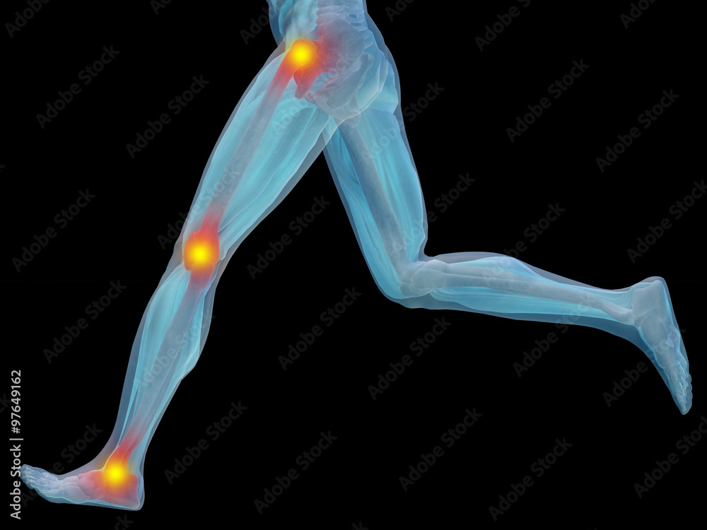 Conceptual human pain anatomy Stock Illustration | Adobe Stock