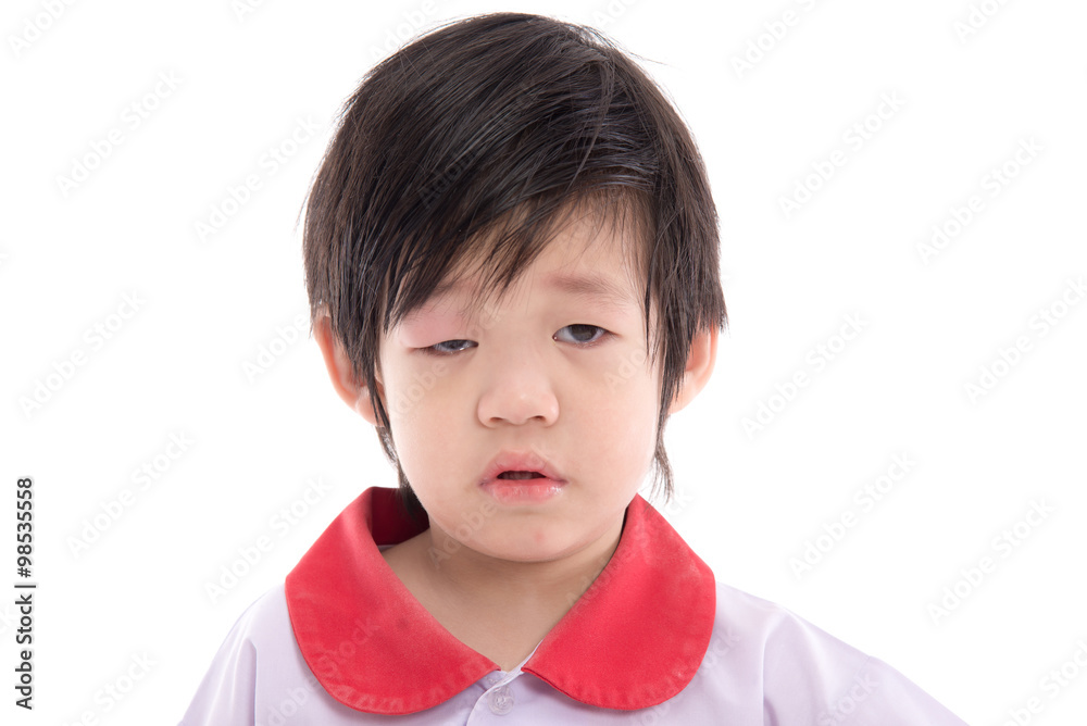 Cute asian child with a swollen eyelid on white background isolated ...