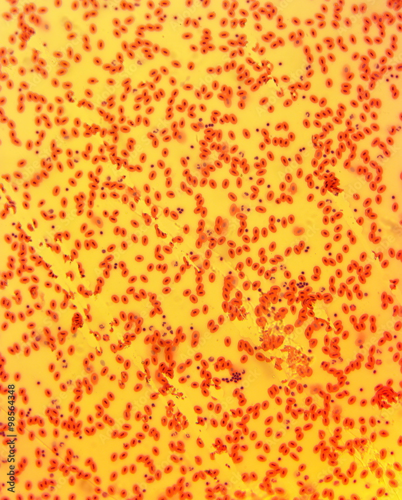Frog (Rana sp.) blood smear (blood cells) (stained by haematoxylin ...