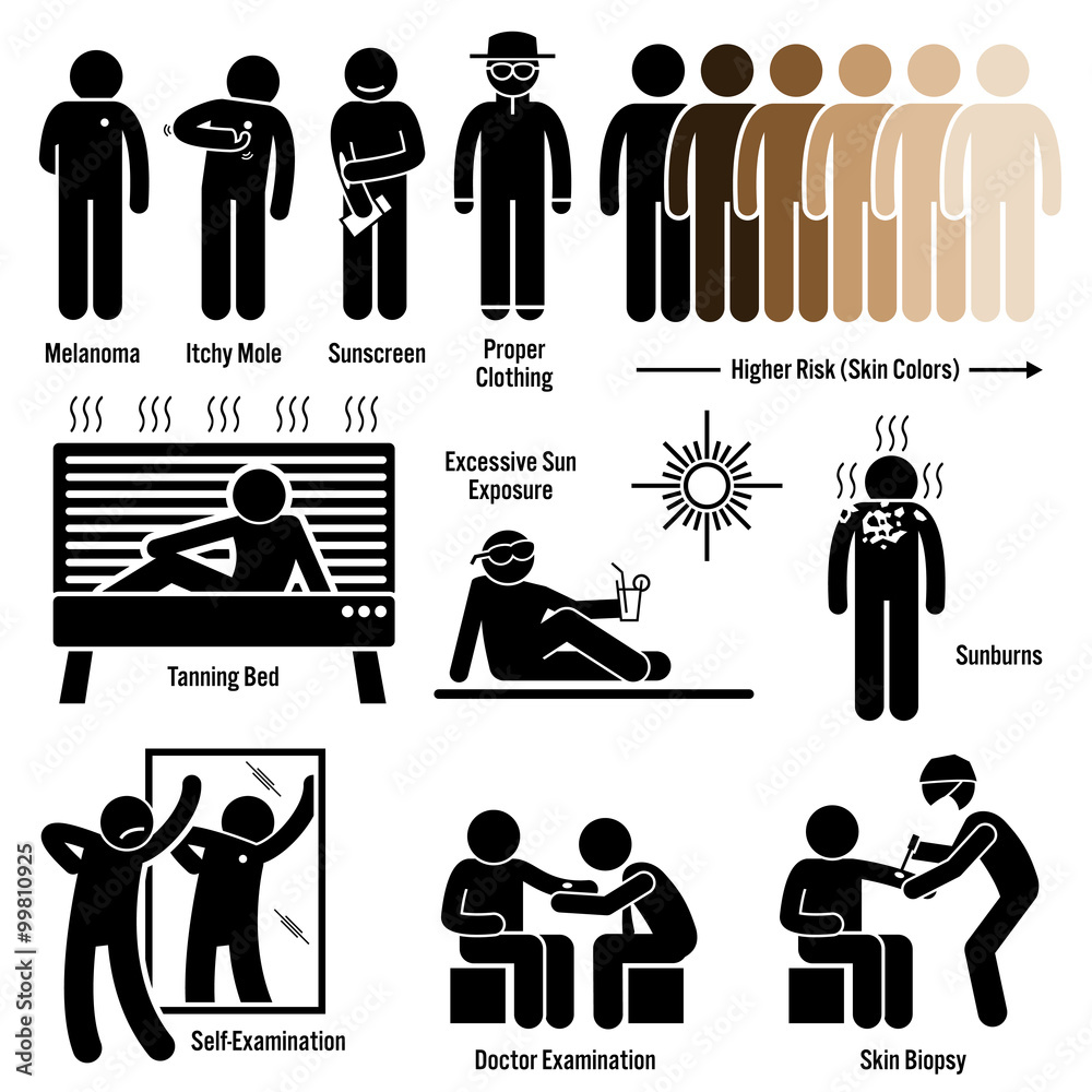 Melanoma Skin Cancer Symptoms Causes Risk Factors Diagnosis Stick ...