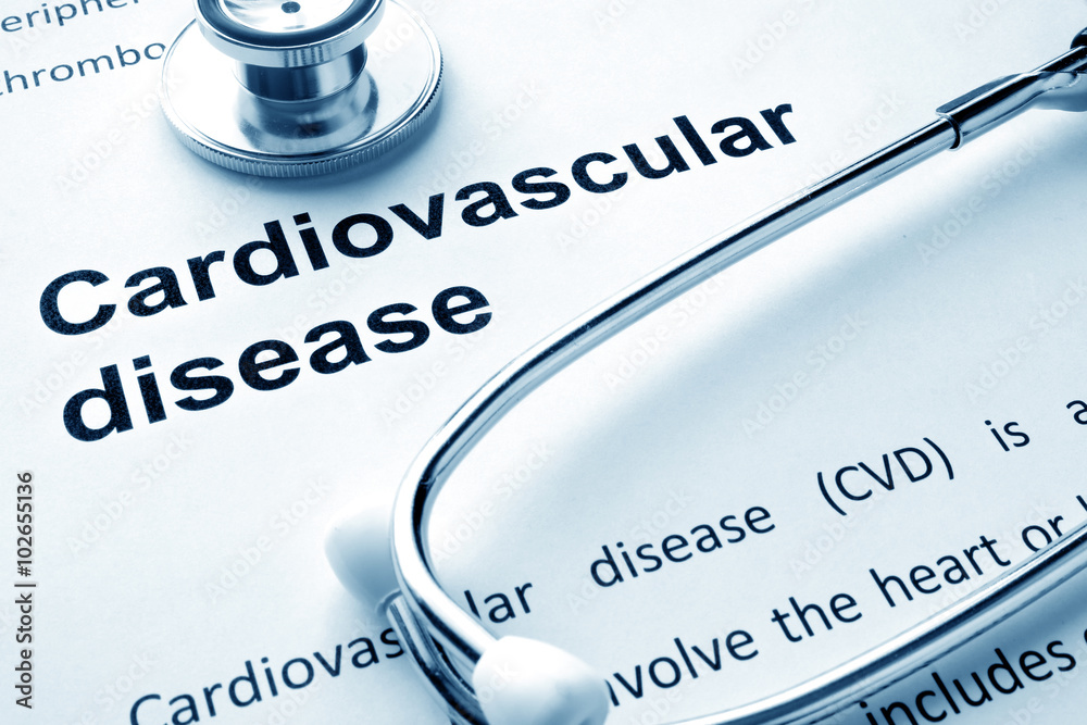 Paper with words Cardiovascular diseases and stethoscope. Stock Photo ...