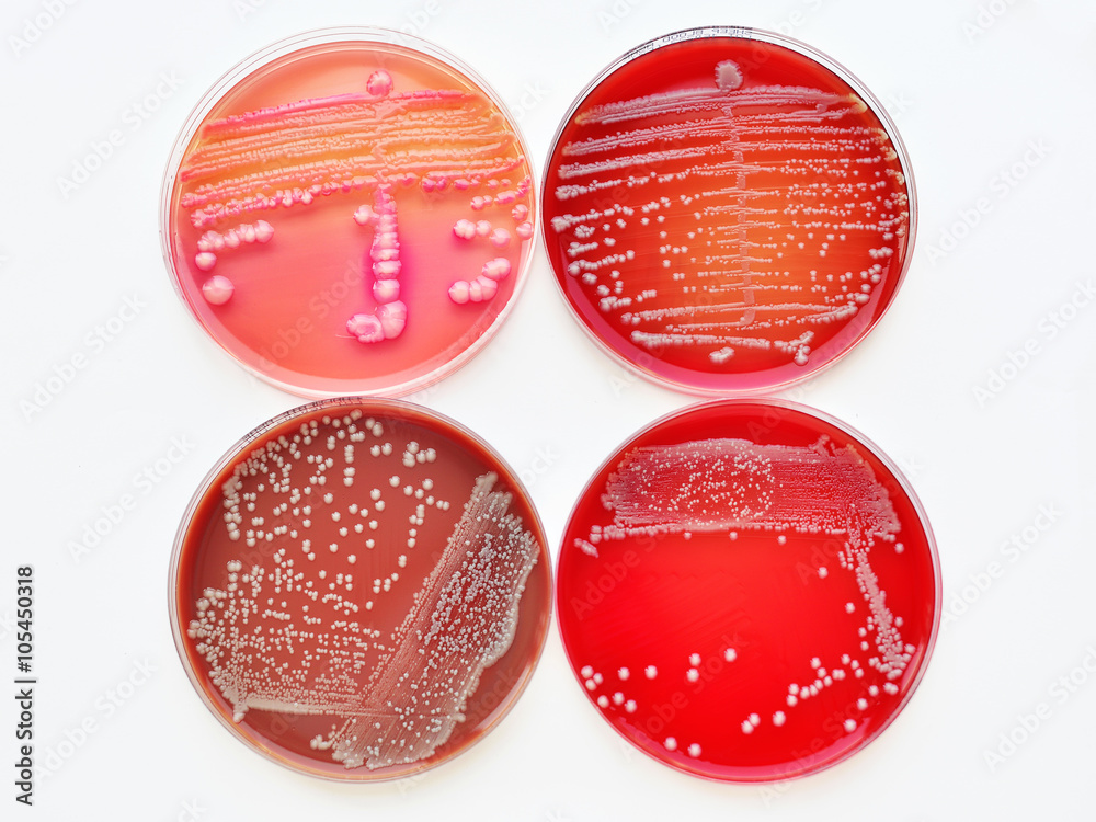 Colonies of bacteria in culture medium plate Stock Photo | Adobe Stock
