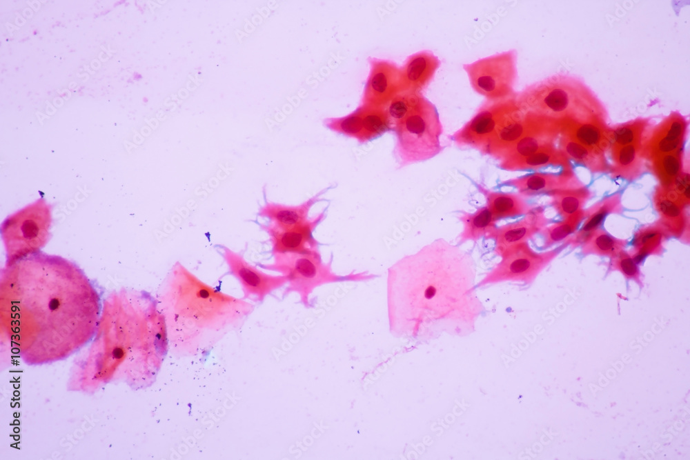 Human cells view in microscopy.Squamous metaplastic cells from pap ...