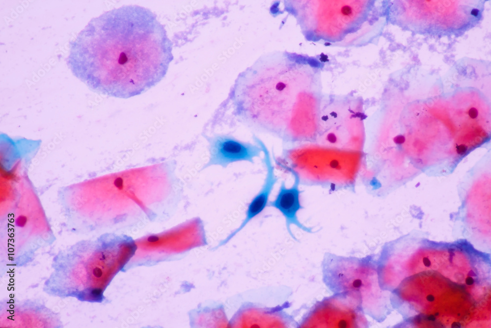 Human cells view in microscopy.Squamous metaplastic cells from pap ...