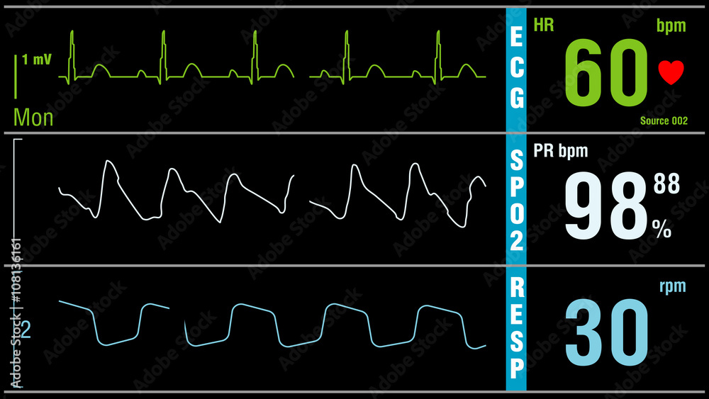 Patient monitor displays vital signs ECG electrocardiogram EKG, oxygen ...