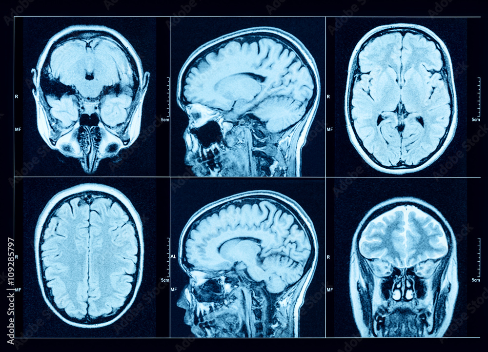 Closeup of a CT scan with brain Stock Photo | Adobe Stock