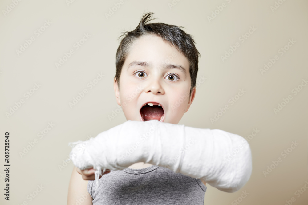 cute boy with broken arm Stock Photo | Adobe Stock