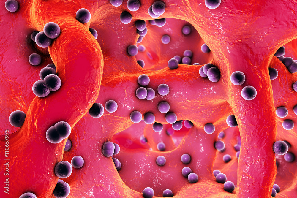 Spherical bacteria inside bone tissue, model of staphylococcus and ...