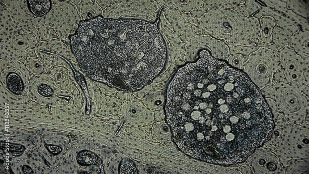 menschliche Zellen unter dem Mikroskop - Anatomie / Histologie ...