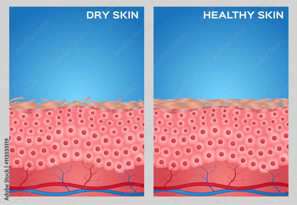 Dry skin, healthy skin texture , vector Stock Vector | Adobe Stock