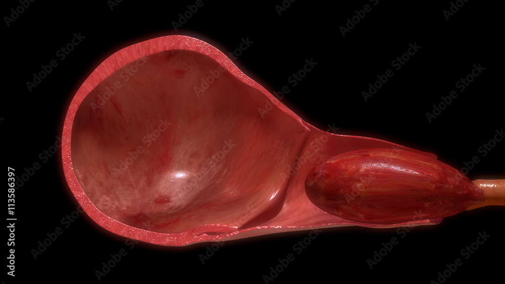 Pulling placenta out of uterus Stock Illustration | Adobe Stock
