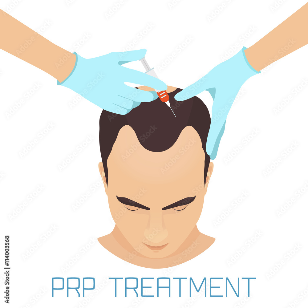 Vetor Platelet rich plasma injection procedure for men. PRP treatment ...