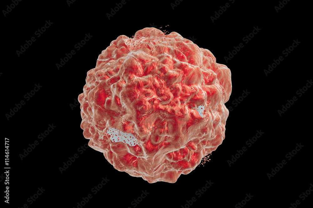 Illustration Stock Destruction of a tumor cell. 3D illustration. Series ...