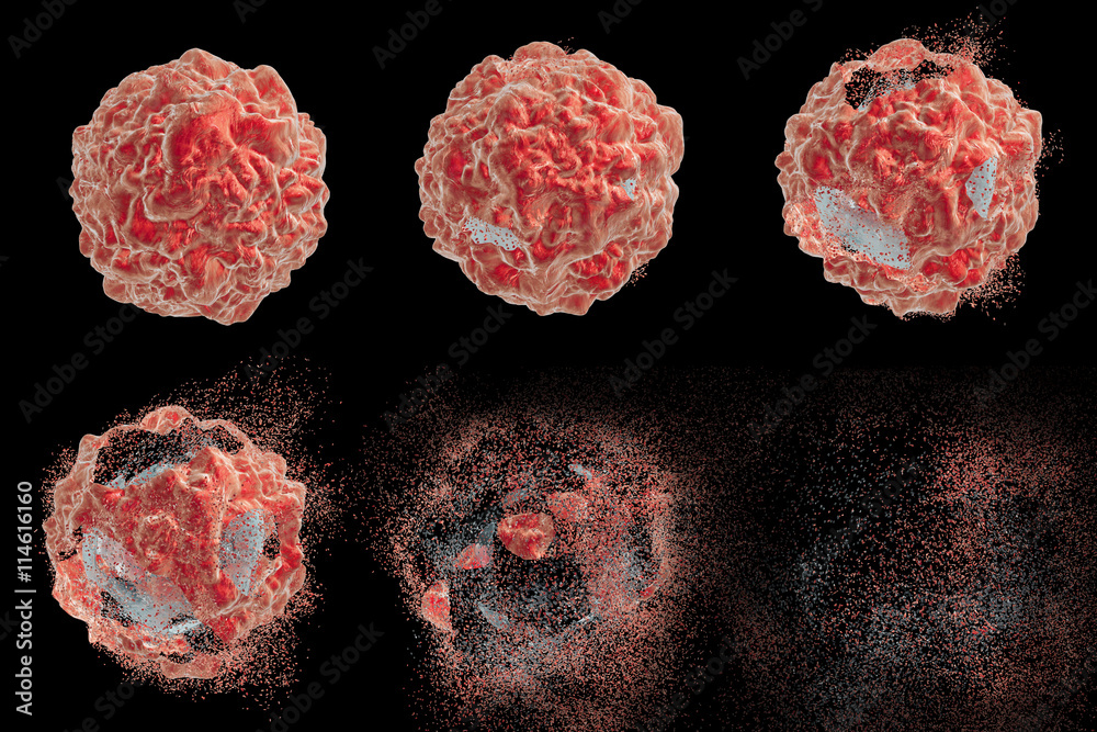 Destruction of a tumor cell. 3D illustration. Series of images showing ...