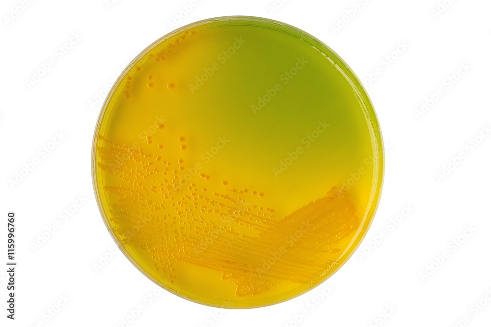 Vibrio cholerae bacterial colonies on TCBS selective medium agar Stock ...