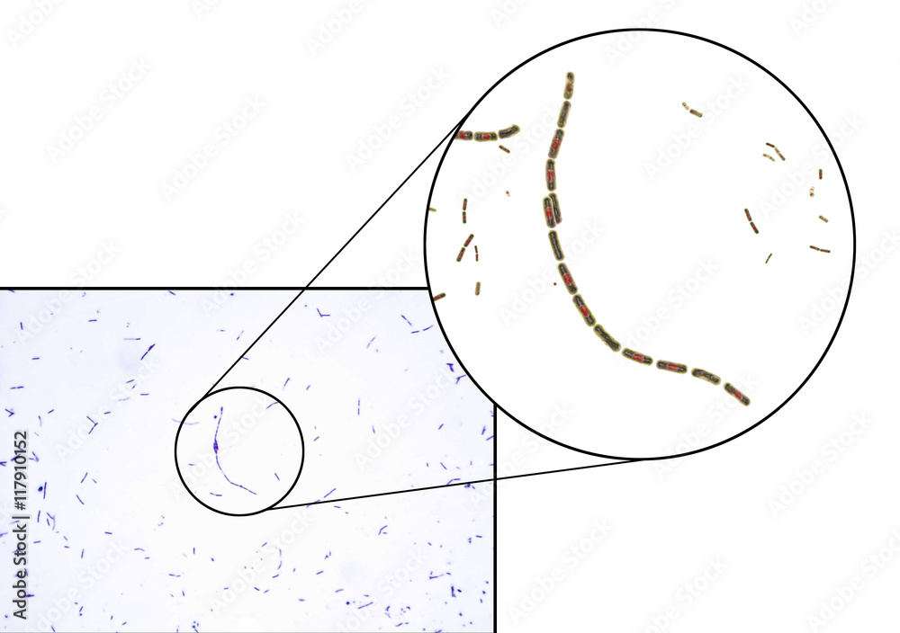 Ilustración de Stock Bacillus anthracis, light micrograph and 3D ...