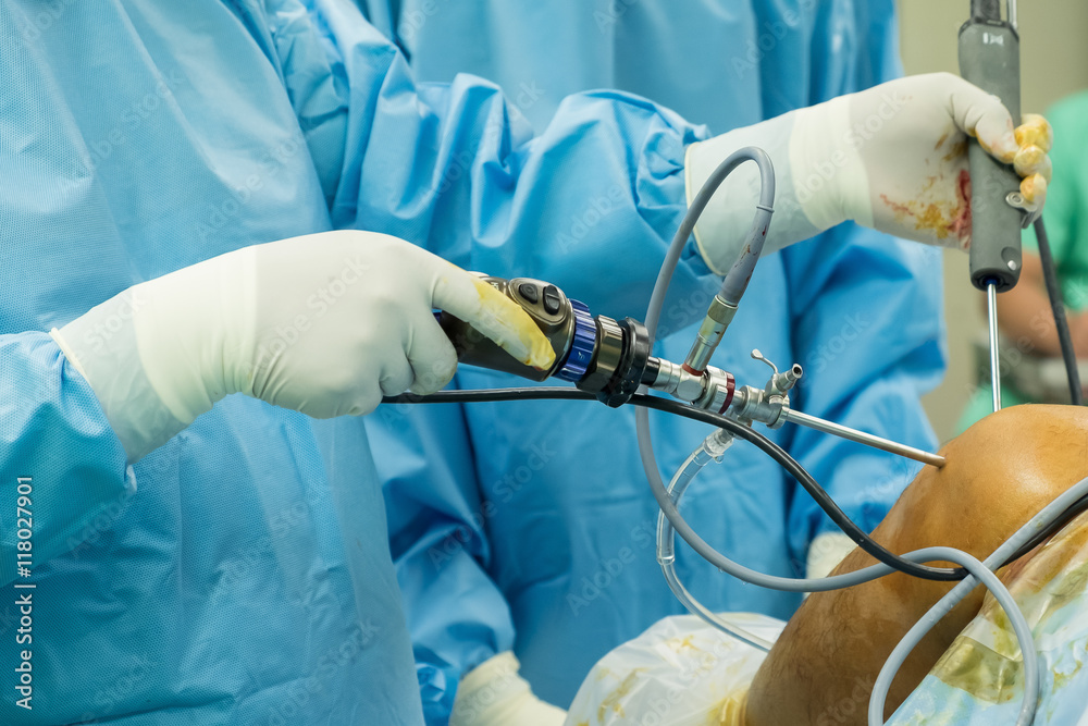 arthroscope surgery Stock Photo | Adobe Stock