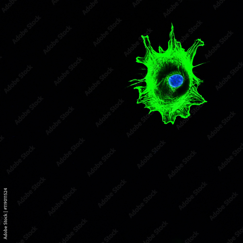 Confocal microscopy imaging of a single cancer cell invading and Stock ...