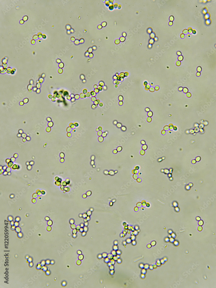 Budding yeast cells in urine, analyze by microscope Stock Photo | Adobe ...