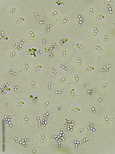 Budding yeast cells in urine, analyze by microscope Stock Photo | Adobe ...