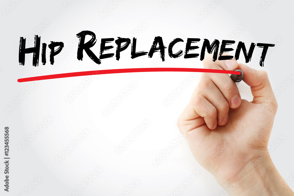 Hand writing Hip replacement with marker, concept background Stock ...