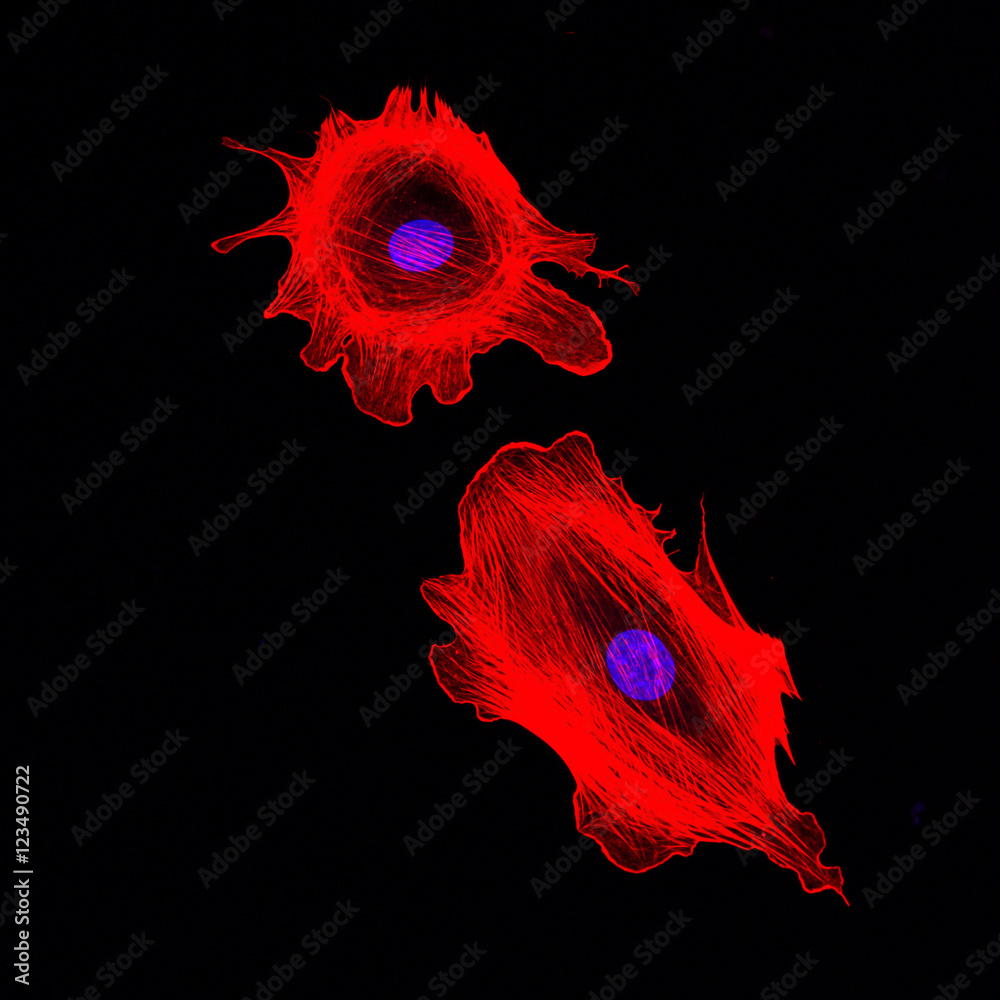 Confocal microscopy imaging of two cancer cells. Cytoskeletal proteins ...