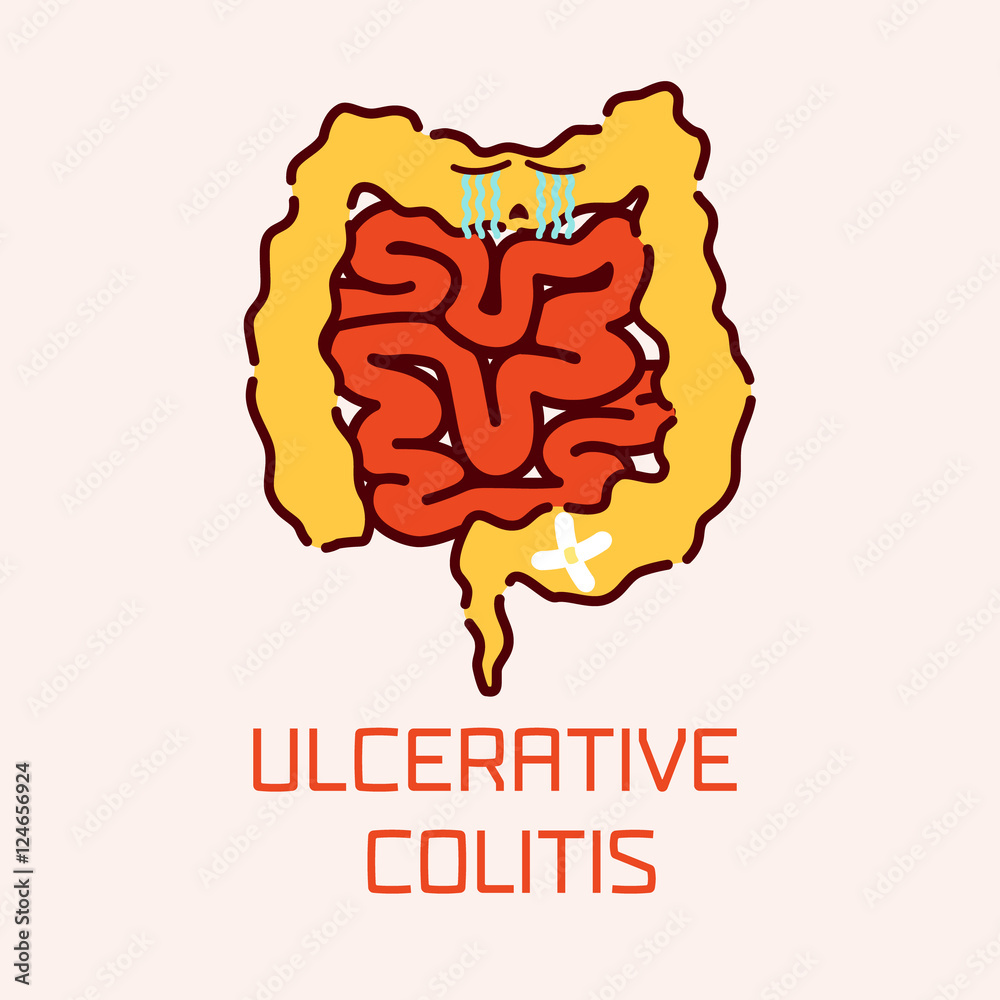 Ulcerative colitis disease awareness poster with sad cartoon intestine ...