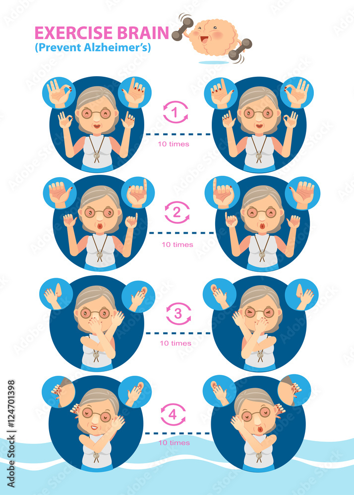 Exercise Brain/Poster demonstration exercise brain Prevent Alzheimer ...