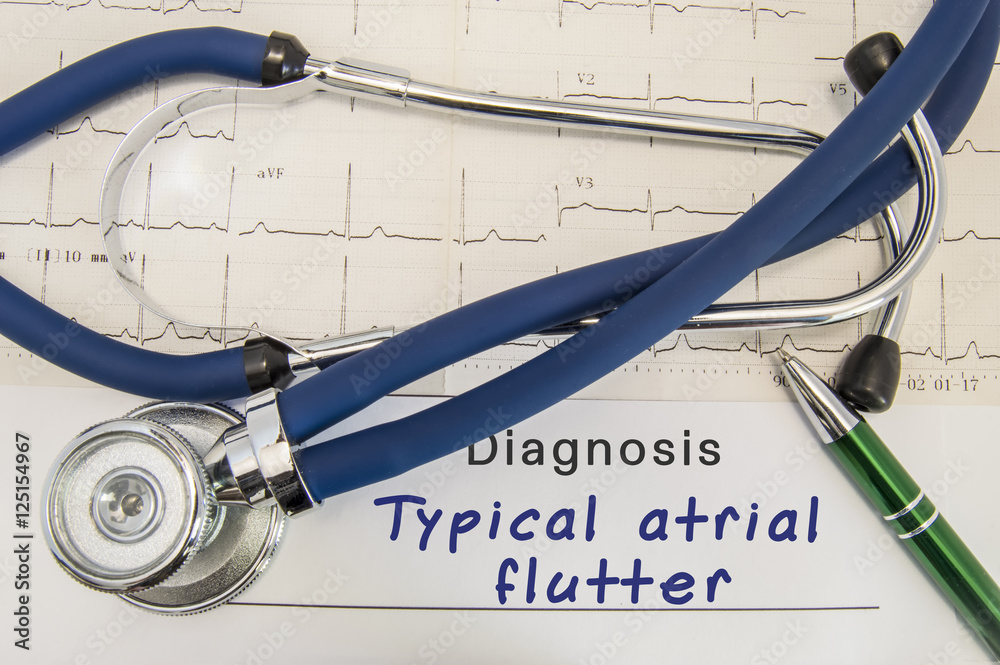 Diagnosis of Typical atrial flutter. Stethoscope and recorded ...