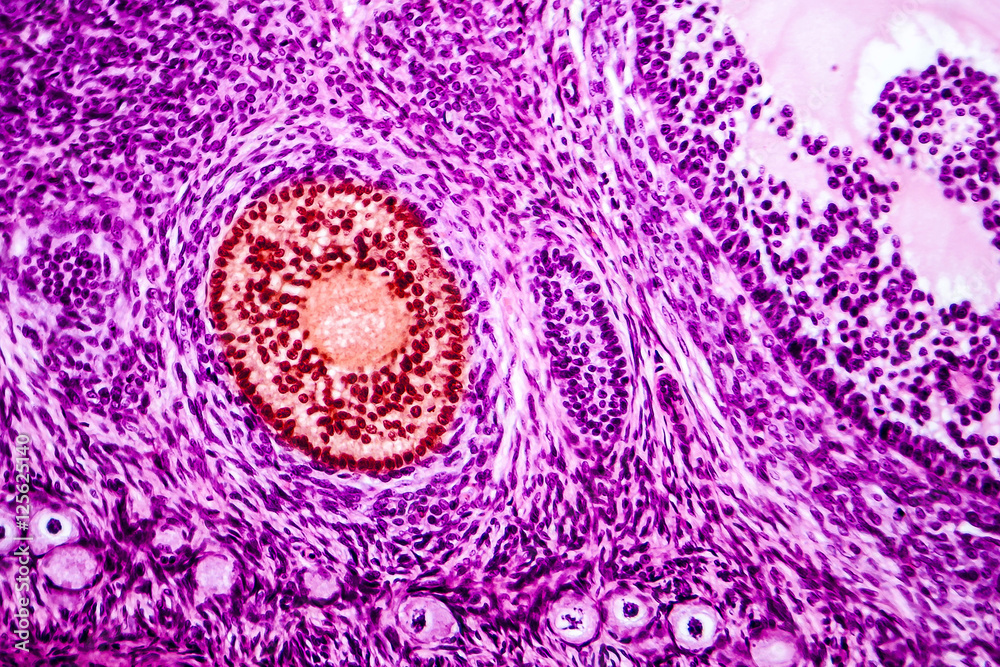 Ovarian follicles. Light microscopy, hematoxylin and eosin stain ...