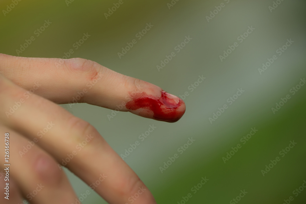bloody human finger Stock Photo | Adobe Stock