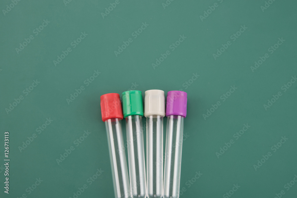 Blood sample tube for laboratory Stock Photo | Adobe Stock