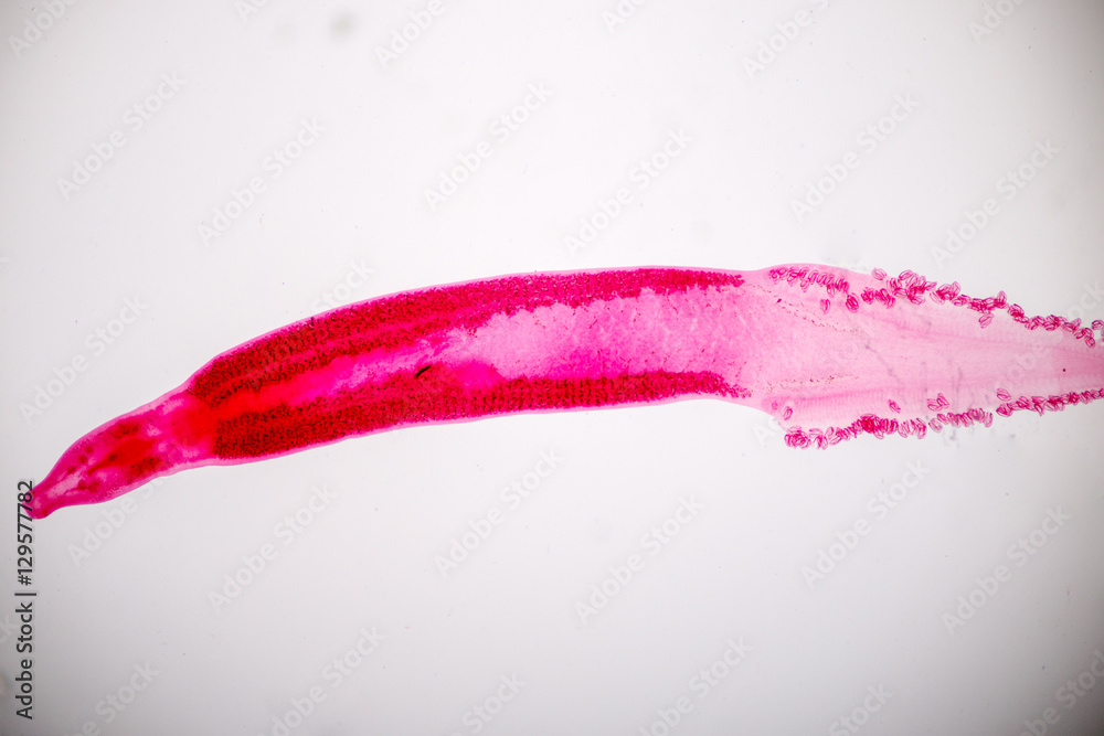 Flukes infestation (parasite) under microscope view. Stock Photo ...