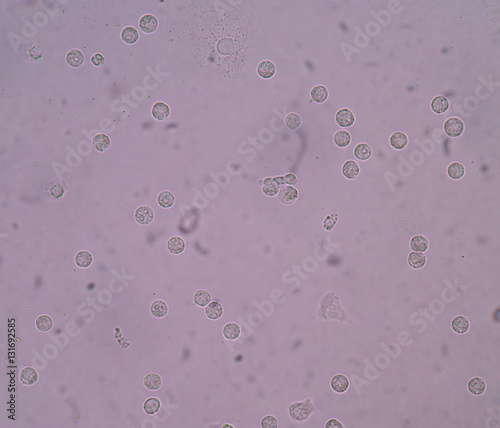 Bacteria in urine specimen under microscope 40x. Stock Photo | Adobe Stock