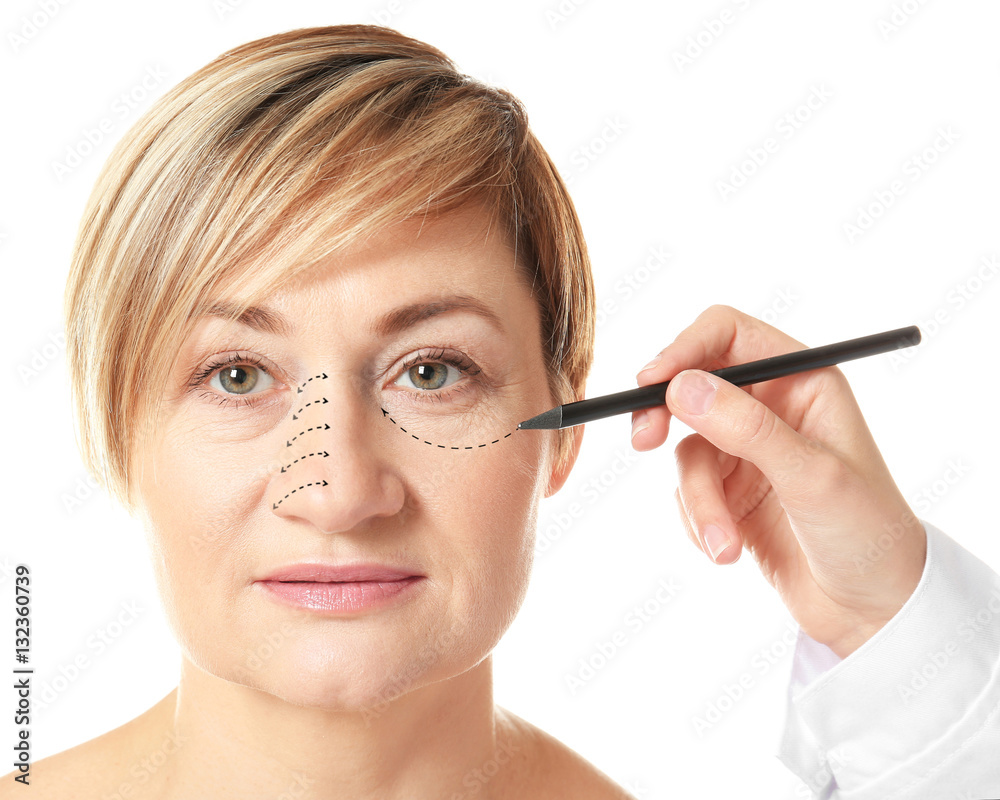Surgeon drawing marks on female face against white background. Plastic ...