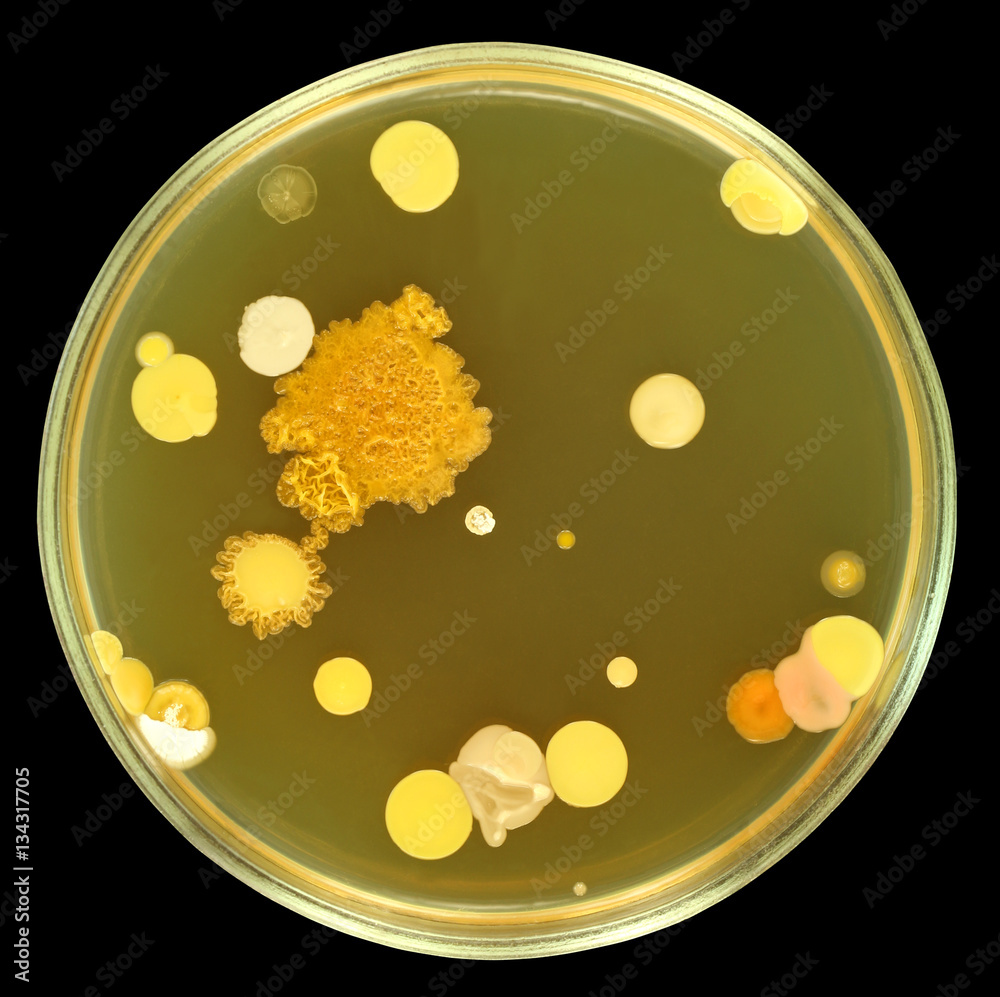 Big colorful colonies of bacteria on a petri dish (agar plate) isolated ...