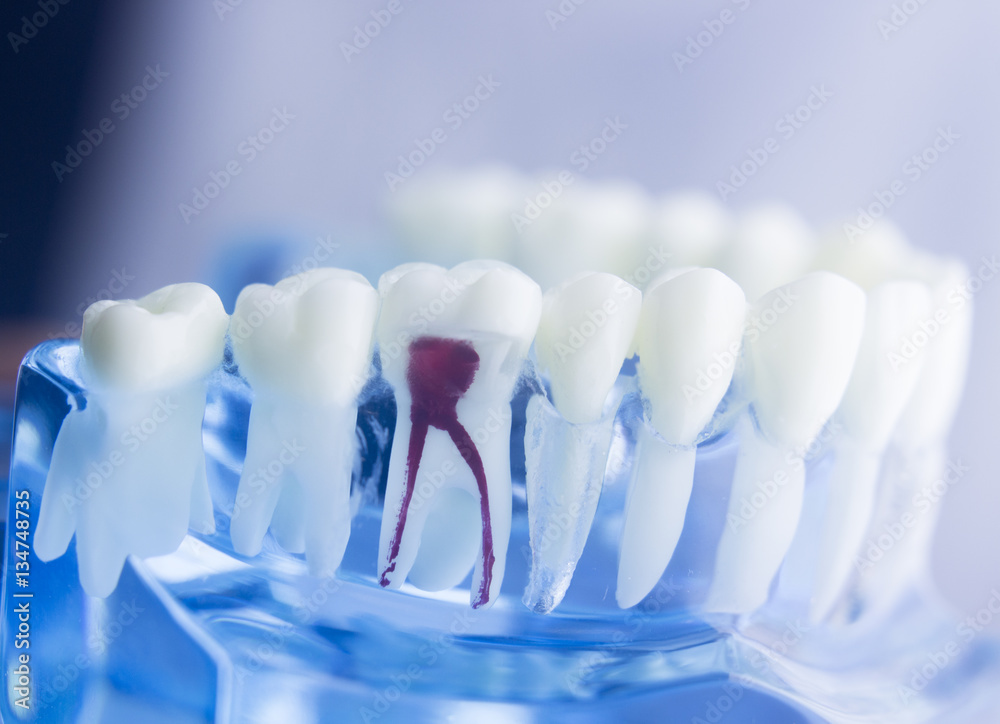 Dental tooth root model Stock Photo | Adobe Stock