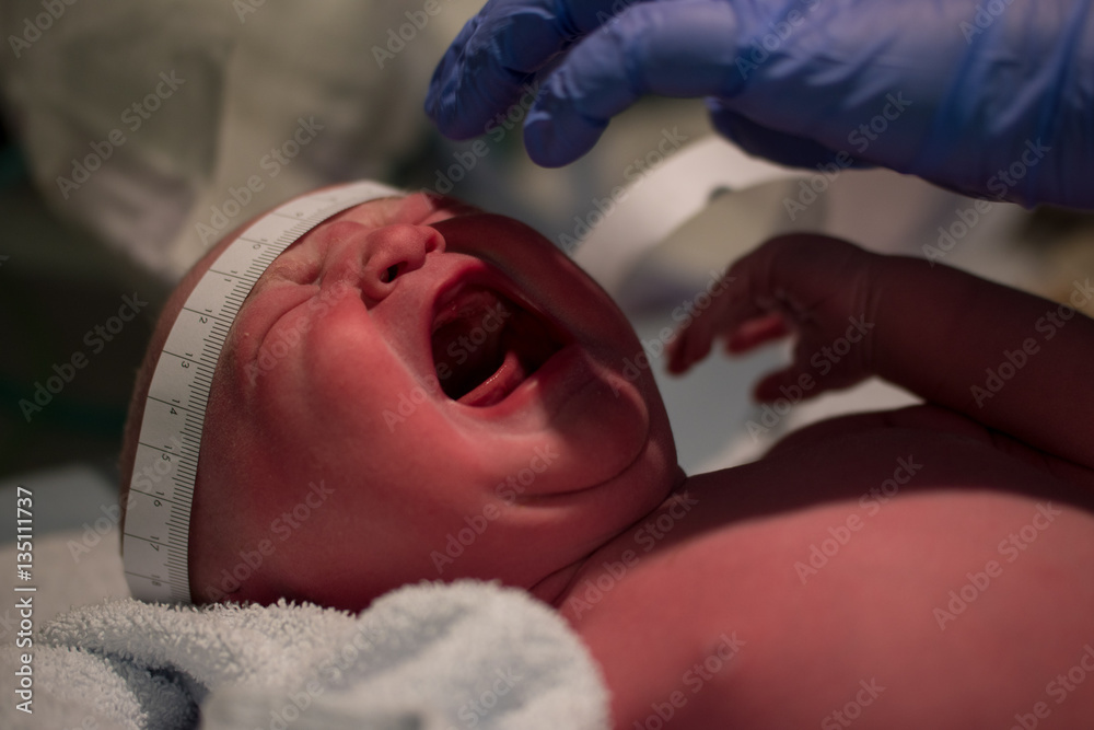 Newborn baby being examined by paediatric doctors moments after birth ...