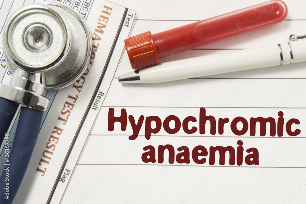 Diagnosis of Hypochromic Anaemia. Test tubes or bottles for blood ...