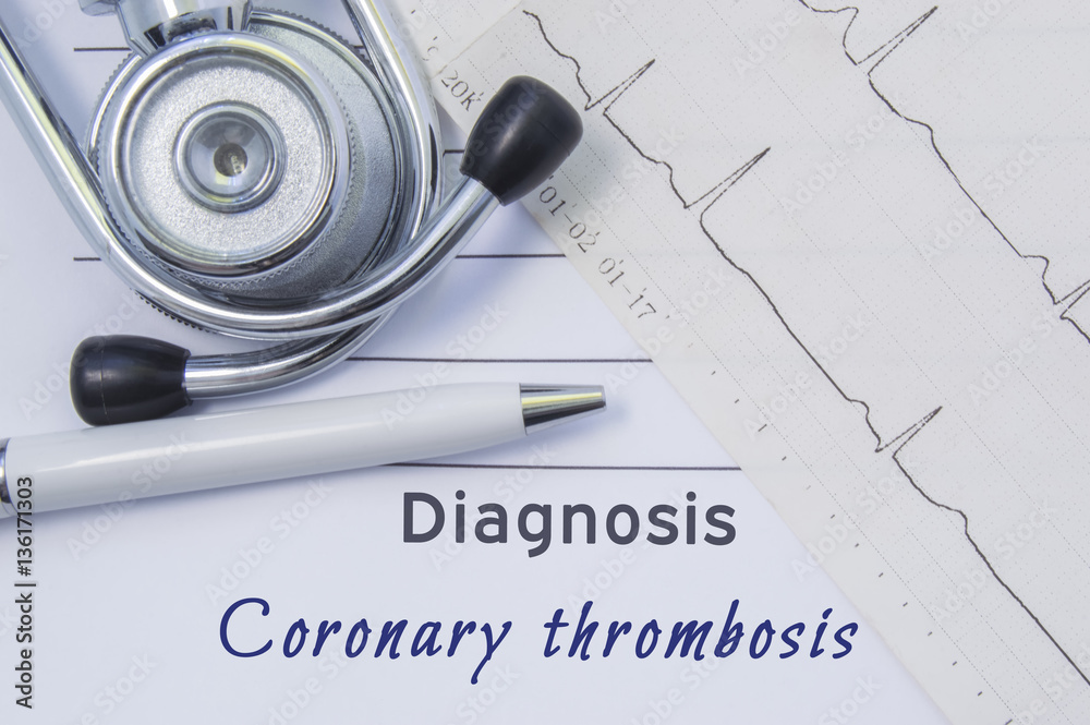 Diagnosis of Coronary thrombosis. Stethoscope, electrocardiogram are on ...